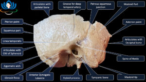 Anatomical Landmarks of the Temporal Bone: A Guide for Surgical Exercises