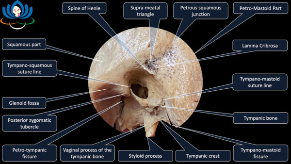 Anatomical Landmarks of the Temporal Bone: A Guide for Surgical Exercises