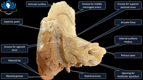 Anatomical Landmarks of the Temporal Bone: A Guide for Surgical Exercises